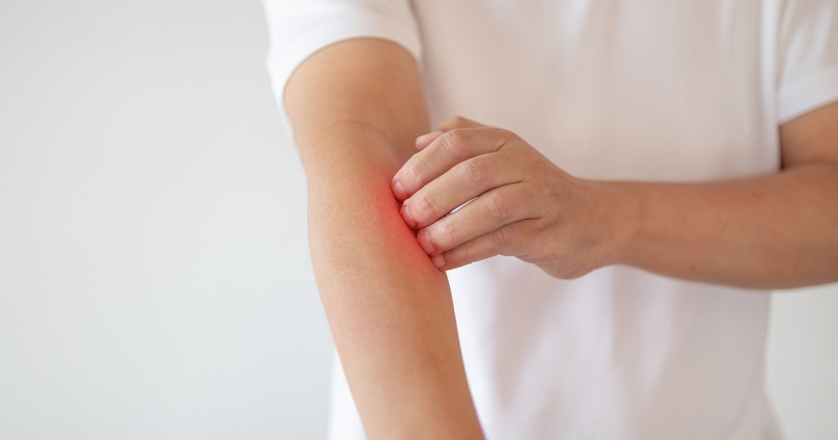 Does anxiety make my skin itch?